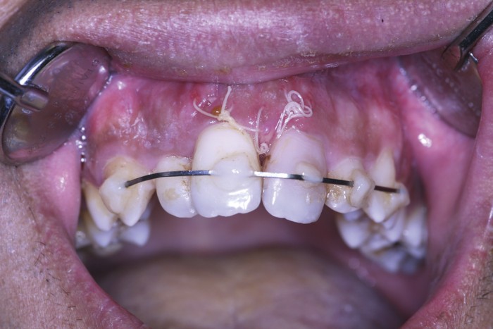 Management of traumatic injuries - Scottish Dental magazine : Scottish ...