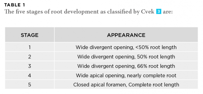 Management of the open apex in endodontics - Scottish Dental magazine ...