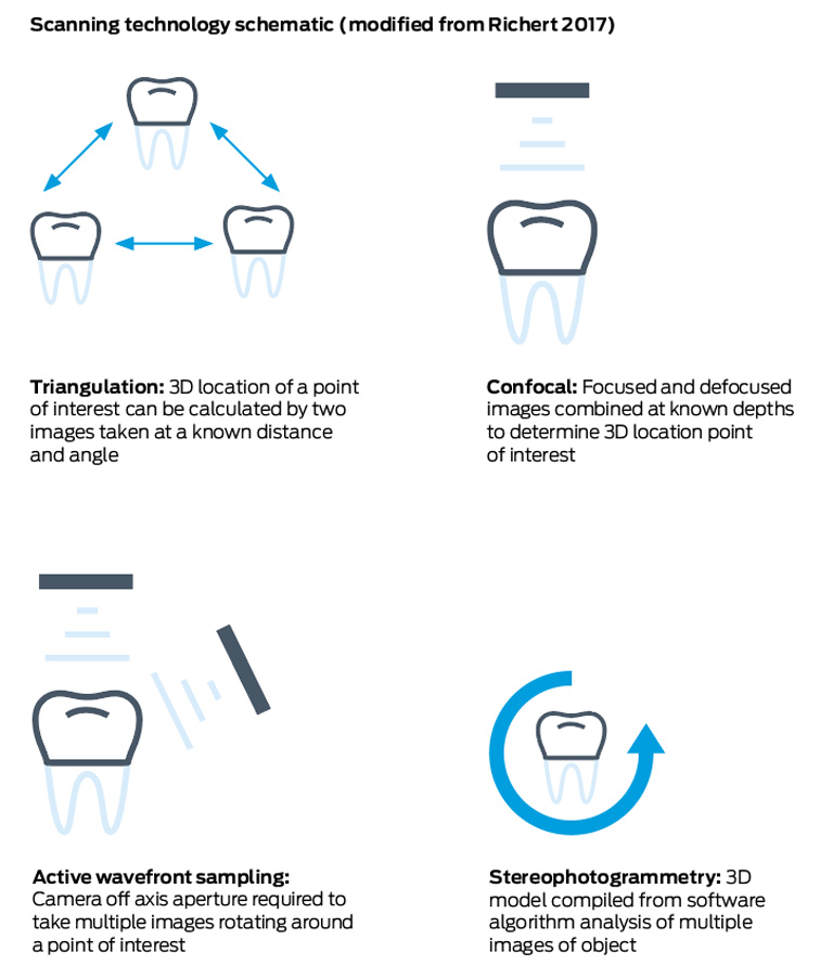 Intraoral scanners In dentistry – an update on digital technology ...