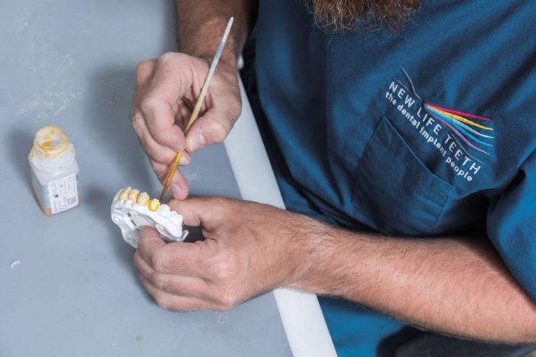 New Life Teeth is the go-to lab for full-arch technical work - Scottish ...